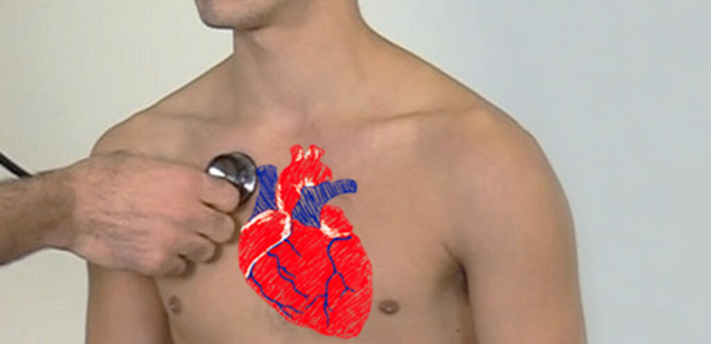 Les foyers d’auscultation cardiaque – Didactique Visuelle